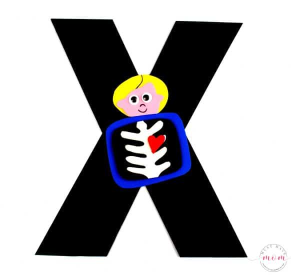 X is for X-Ray Letter Craft {Free Printables} - Must Have Mom